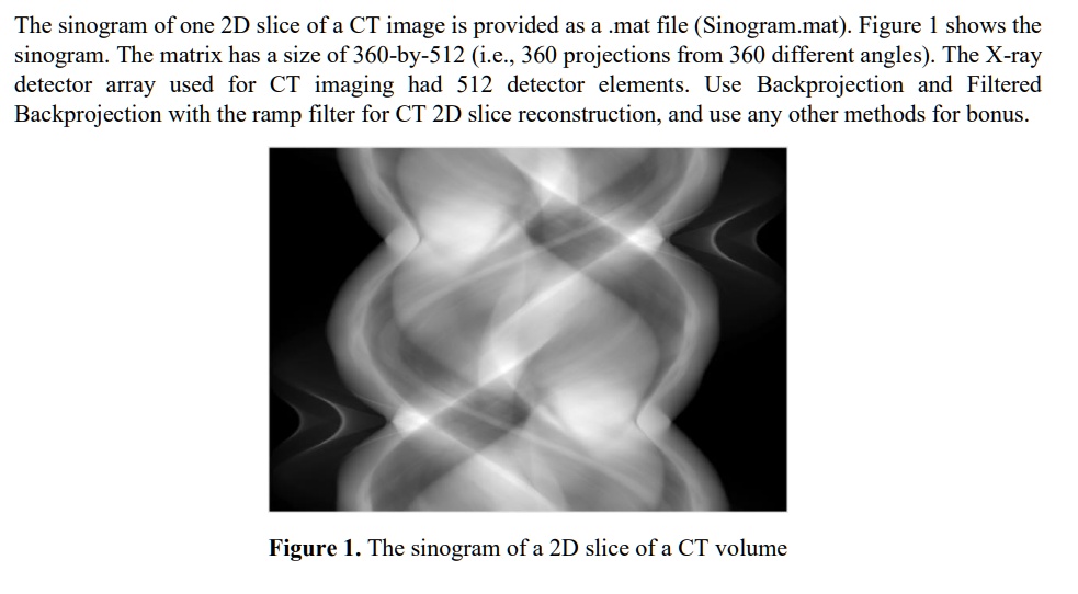 SOLVED: The sinogram of one 2D slice of a CT image is provided as a .mat file (Sinogram.mat ...