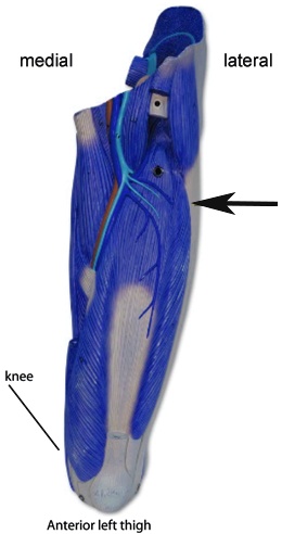Which structure is indicated by the arrow? iliotibial tract vastus ...