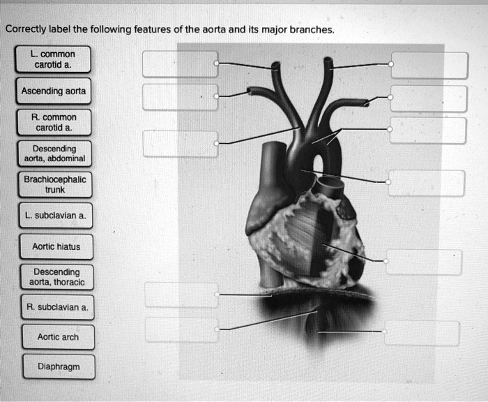 Correctly label the following features of the aorta and its major ...