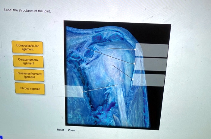 SOLVED: Label the structures of the joint. Coracoclavicular ligament ...