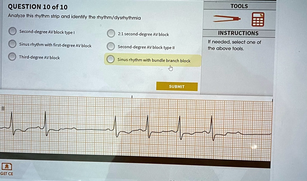 QUESTION 10 of 10: Analyze this rhythm strip and identify the rhythm ...