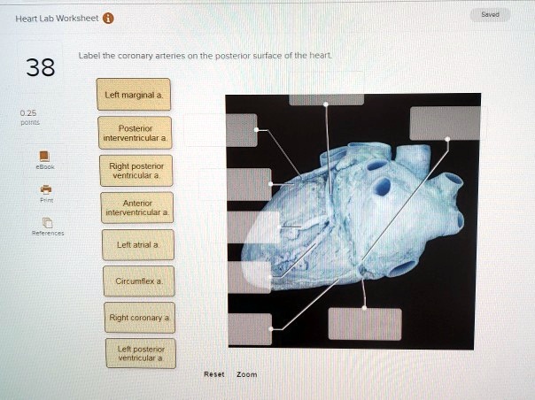 Heart Lab Worksheet Label the coronary arteries on the posterior ...