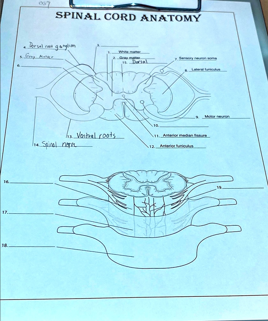 spinal cord anatomy 1 dorsal root ganglion 2 gray matter 3 white matter ...