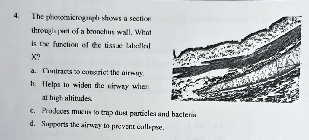 the photomicrograph shows a section through part of a bronchus wall ...