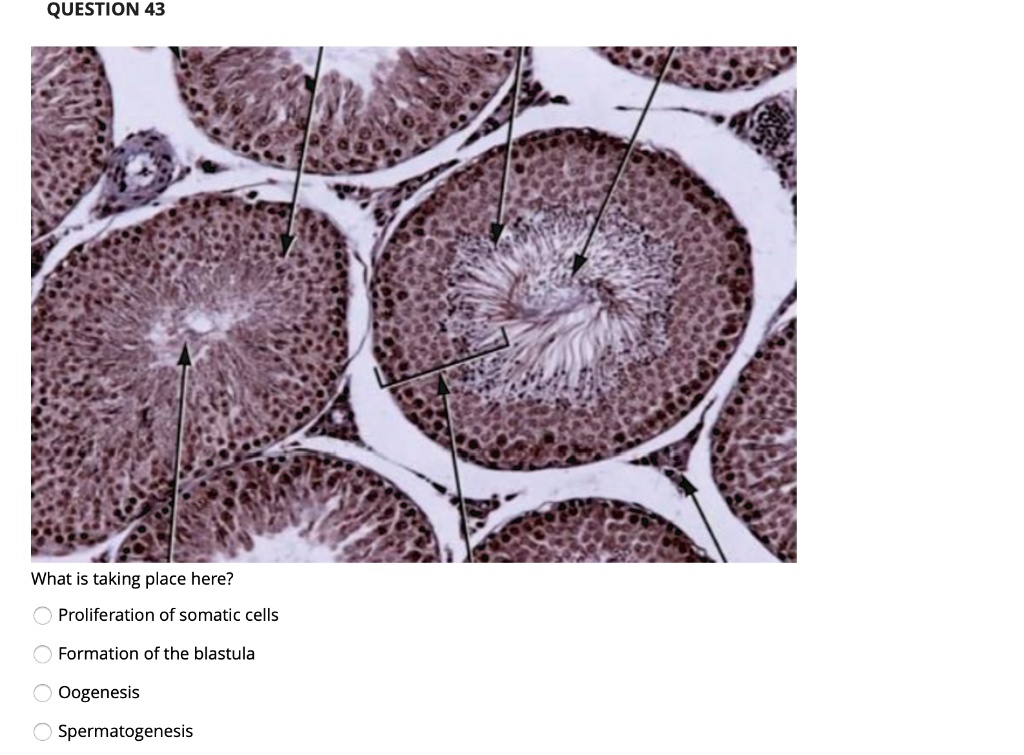 SOLVED:QUESTION 43 What is taking place here? Proliferation of somatic ...