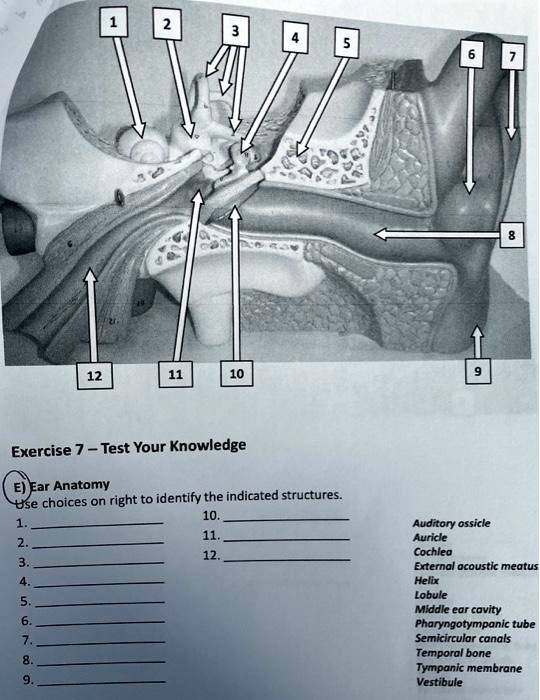VIDEO solution: Exercise 7 - Test Your Knowledge Ear Anatomy: Use the ...