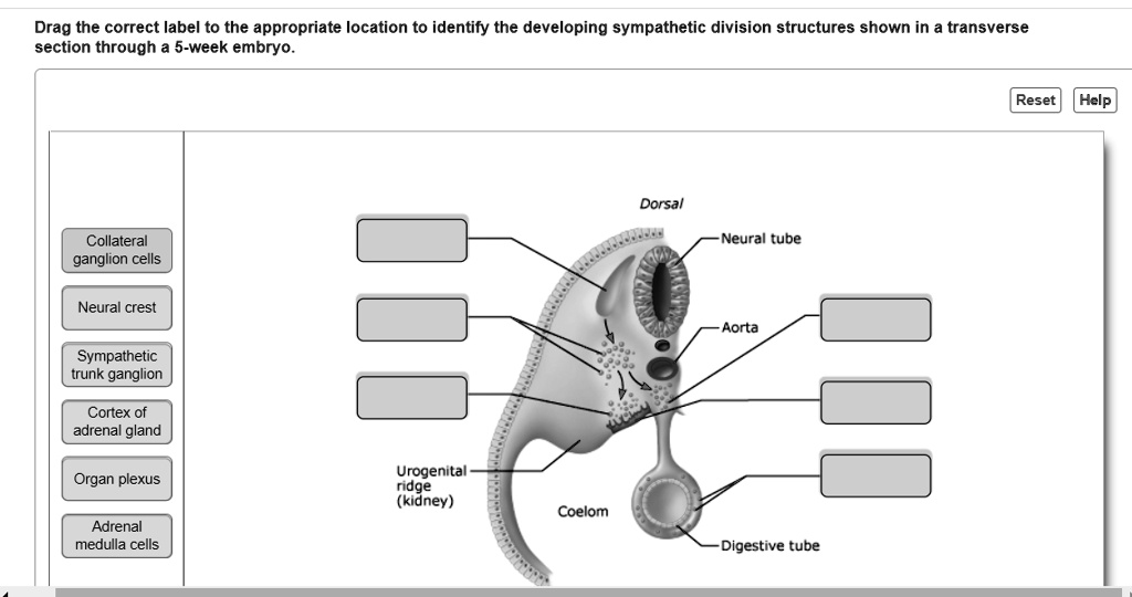 Drag the correct label to the appropriate location to identify the ...