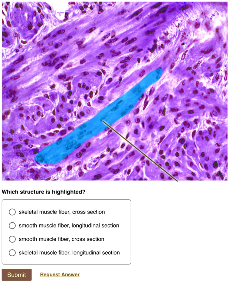 which structure is highlighted skeletal muscle fiber cross section ...