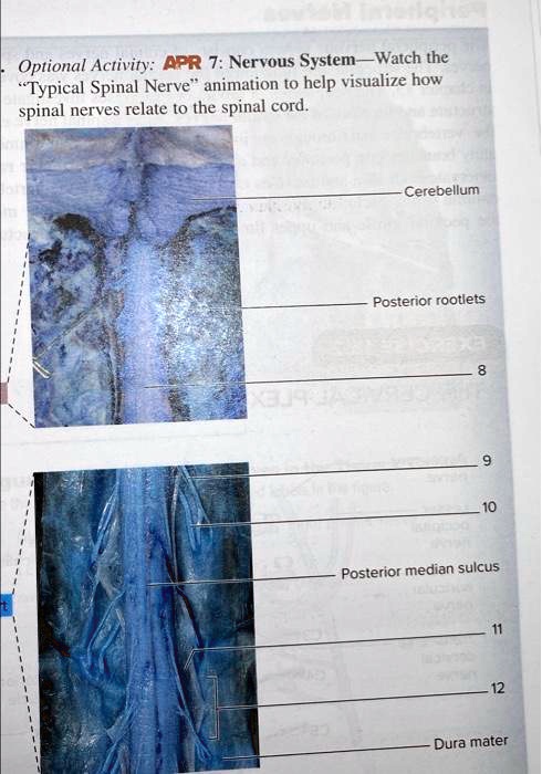 Label: Typical Spinal Nerve Optional Activity: APR 7 - Nervous System ...