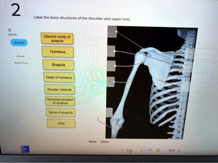 2 Label the bony structures of the shoulder and upper limb. 10 points Skipped eBook References ...