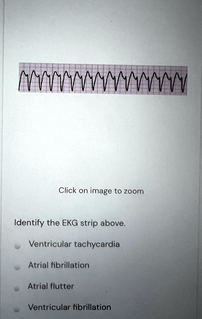 click on image to zoom identify the ekg strip above ventricular ...