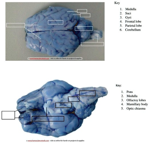 SOLVED: Medulla Suci Gyri Frontallcha Parietal lobe Cerebellum Kev ...