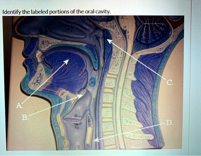 SOLVED: Identify the labeled portions of the oral cavity: A B ID
