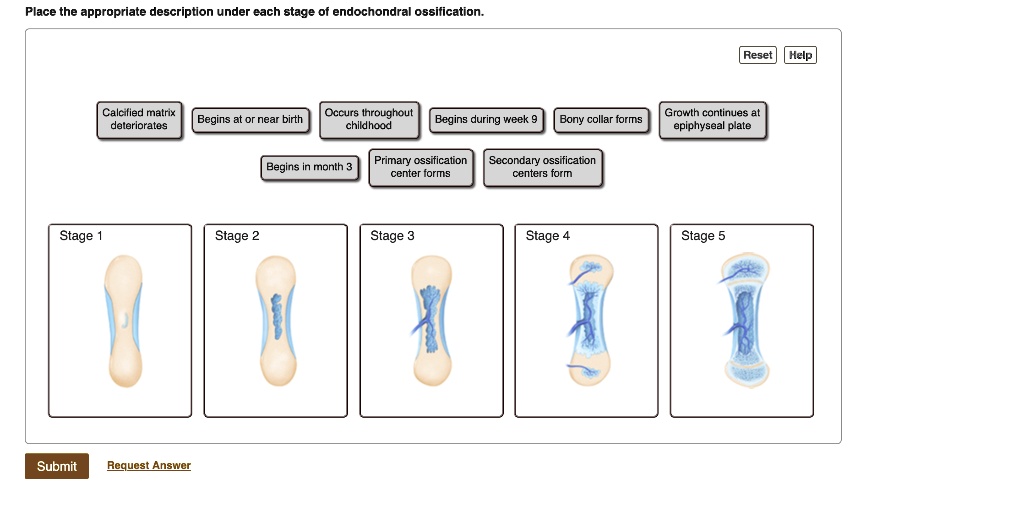 SOLVED: Calcified matrix deteriorates Occurs throughout childhood ...