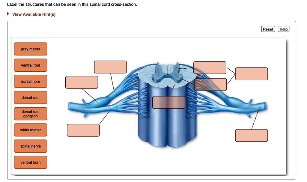 SOLVED: Label the structures that can be seen in this spinal cord cross ...