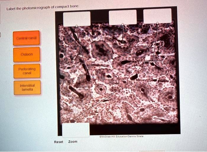 Label the photomicrograph of compact bone. Central canal Osteon ...