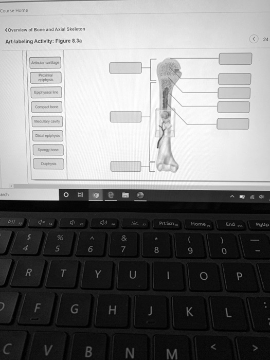 SOLVED: Course Home Overview of Bone and Axial Skeleton Art-labeling ...