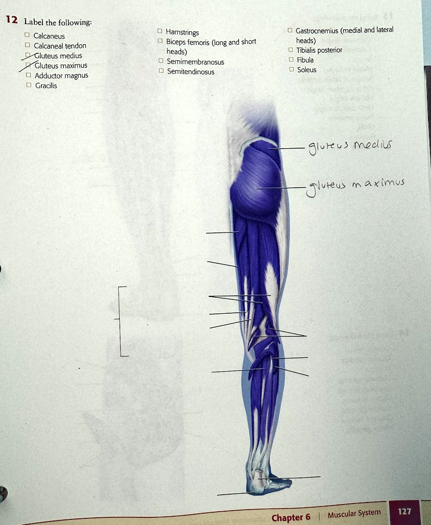 12 Label the following: Calcaneus Calcaneal tendon Gluteus medius ...