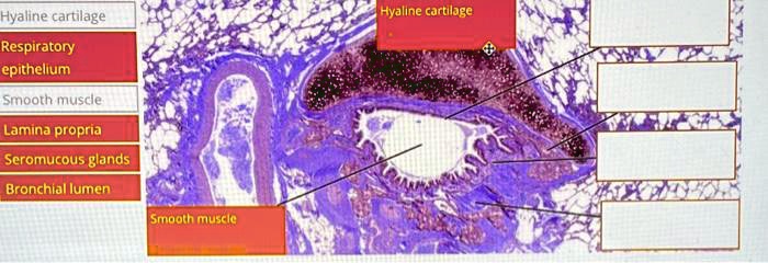 SOLVED: Can someone help label this with an explanation? Hyaline ... SOLVED: Can someone help label this with an explanation? Hyaline ...