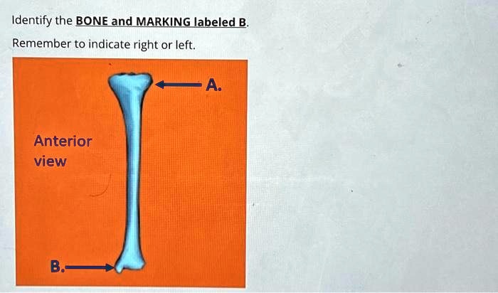 [GET ANSWER] Identify the BONE and MARKING labeled B. Remember to ...