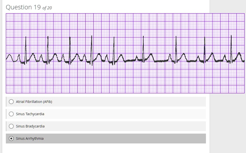 question 19 of 20 atrial fibrillation afib sinus tachycardia sinus ...