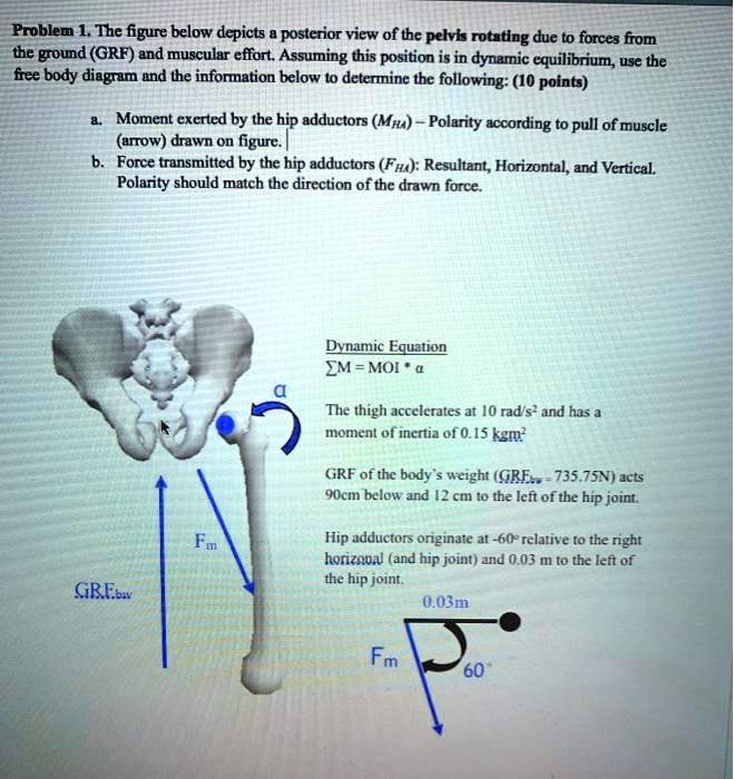 Problem 1. The figure below depicts a posterior view of the pelvis ...