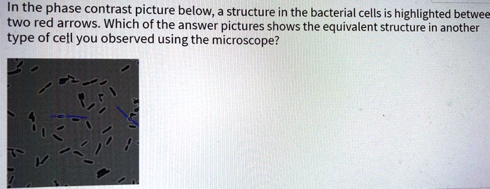 SOLVED: In the phase contrast picture below, the structure in the ...