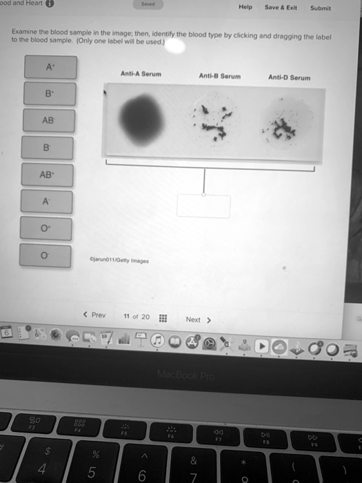 pod and hean help sav0 submit examine the blood sample the image then ...