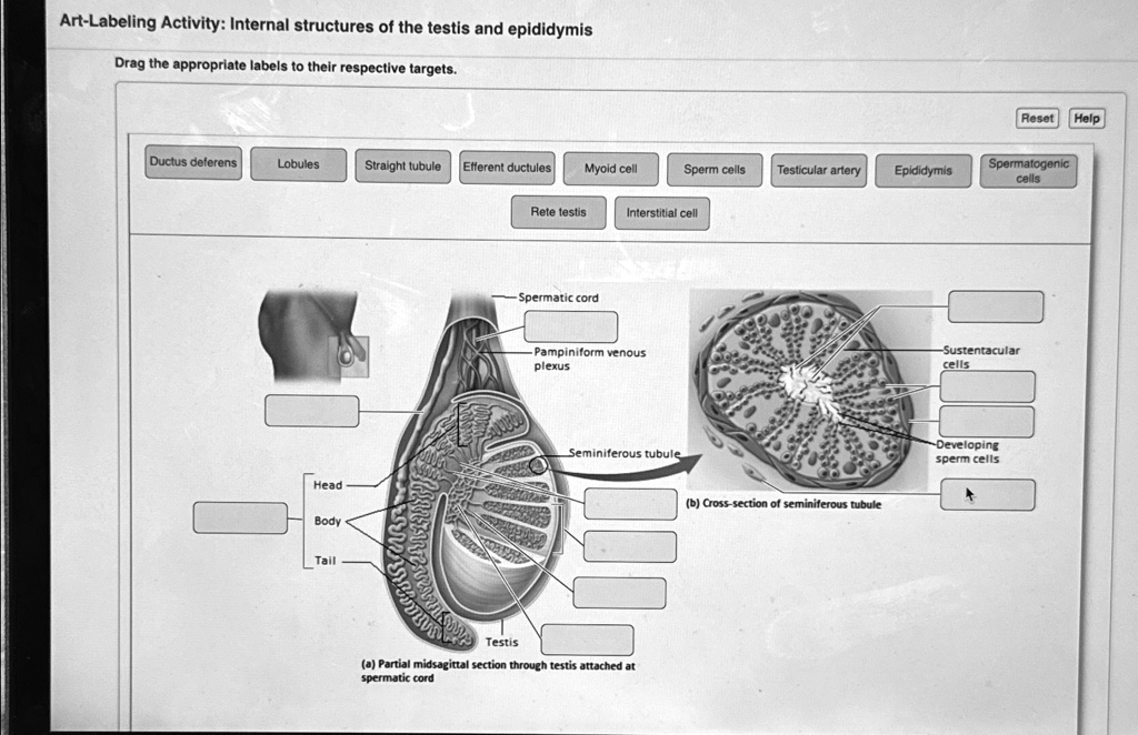 Art-Labeling Activity: Internal structures of the testis and epididymis ...
