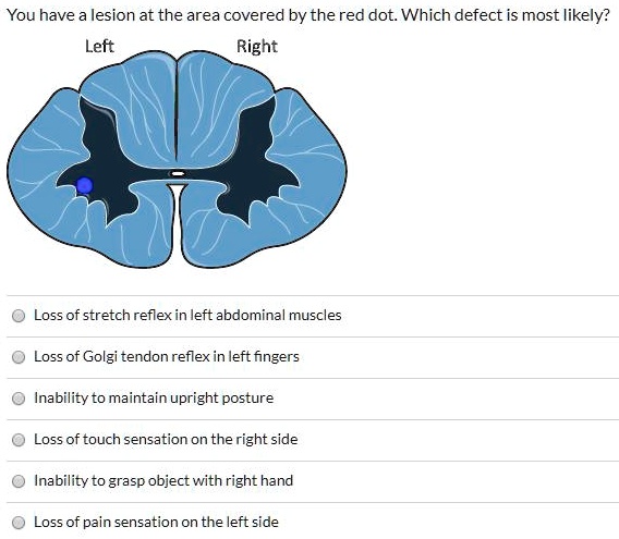 [GET ANSWER] you have a lesion at the area covered by the red dot which ...