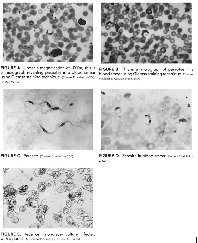 SOLVED:FIGURE A_ Under a magnification of 1OOOx, this is FIGURE B. This ...