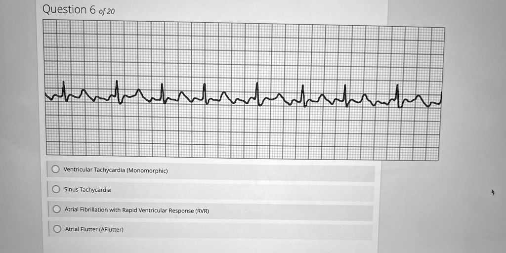 question 6 of 20 a ventricular tachycardia monomorphic b sinus tachycardia c atrial fibrillation ...