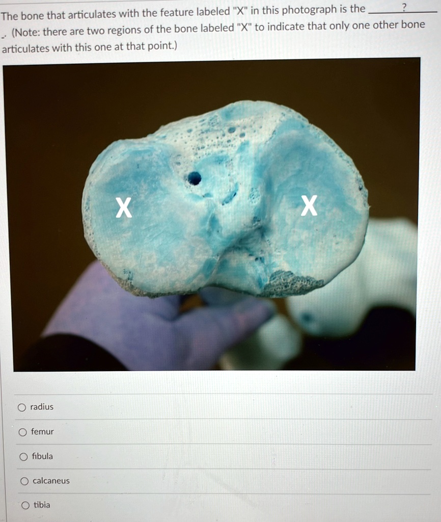 the bone that articulates with the feature labeled x in this photograph ...