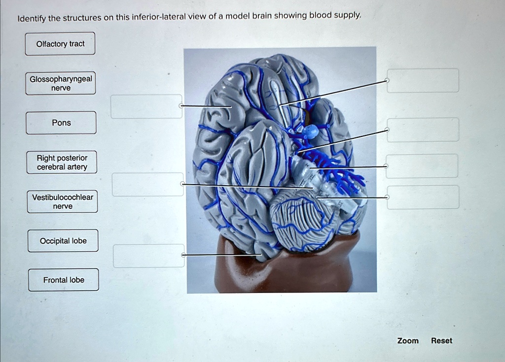 Identify the structures on this inferior-lateral view of a model brain ...