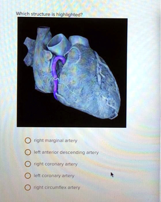 SOLVED: Which structure is highlighted? right marginal artery left anterior descending artery ...