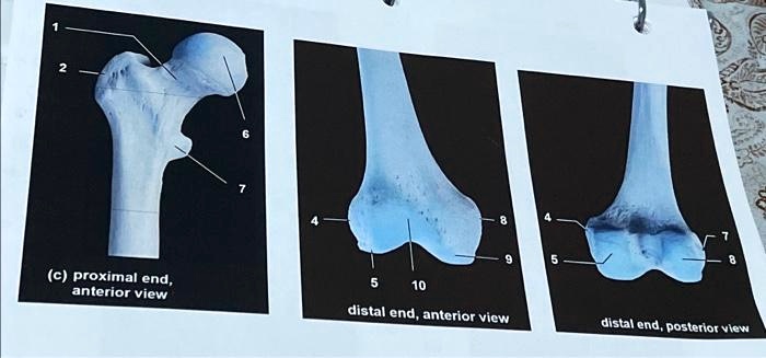 SOLVED: 2 (c) proximal end, anterior view 6 5 10 8 distal end, anterior ...
