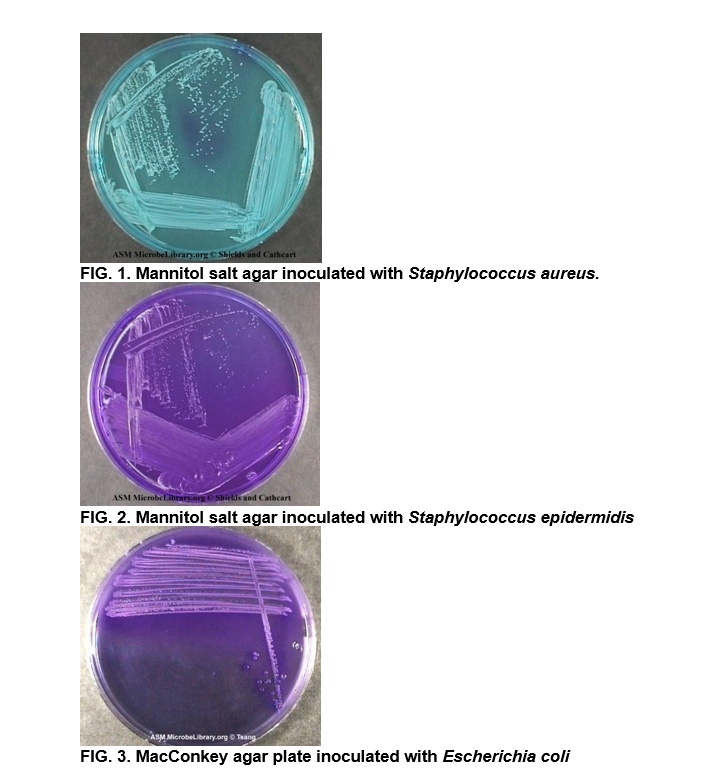 FIG 1 Mannitol salt agar inoculated with Staphylococcus aureus: Whan ...