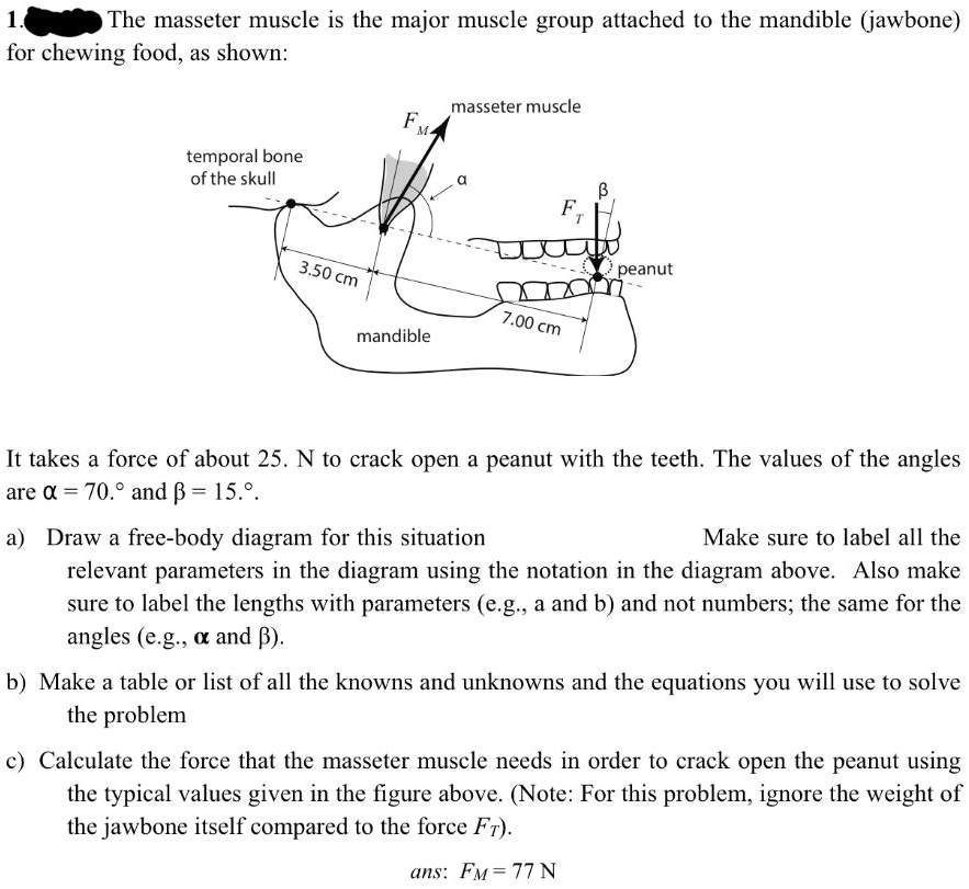 1. The masseter muscle is the major muscle group attached to the ...