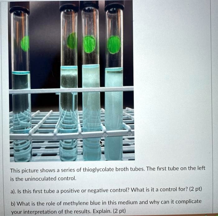 SOLVED:This picture shows a series of thioglycolate broth tubes The ...