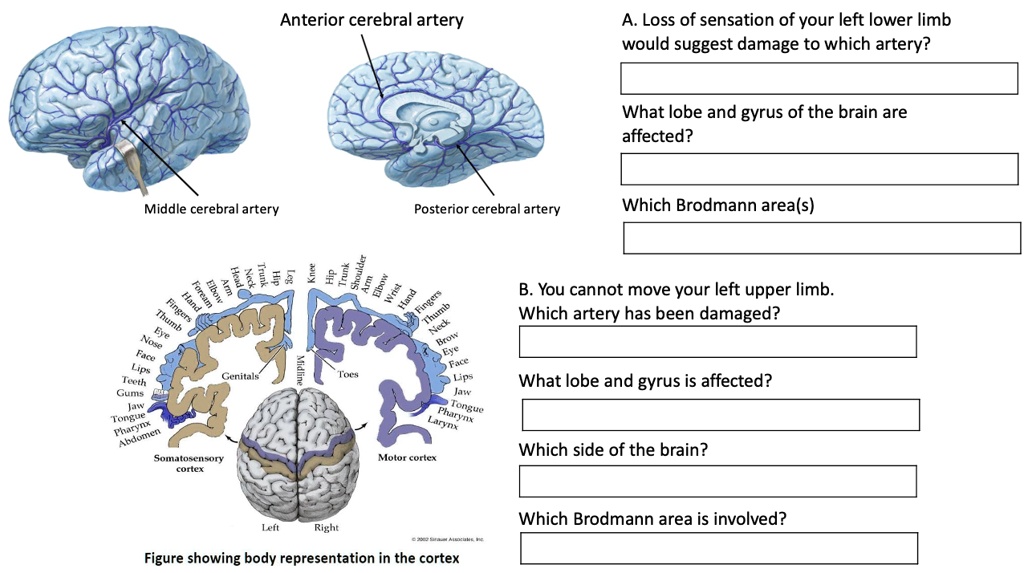 SOLVED: Anterior cerebralartery A.Loss of sensation of your left lower ...