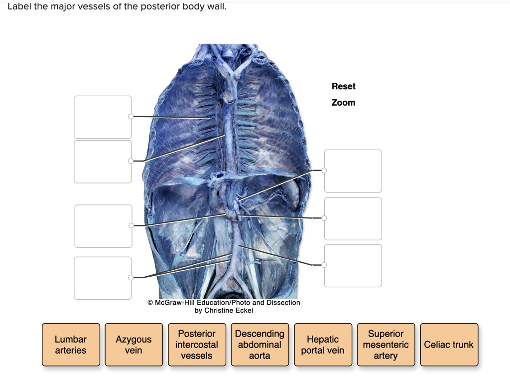 SOLVED: Label the major vessels of the posterior body wall. Reset Zoom ...
