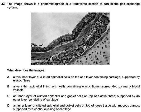 33 The image shown is a photomicrograph of a transverse section of part ...