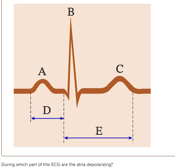 B A C D E During which part of this ECG are the atria depolarizing?