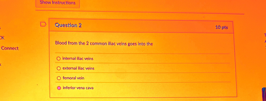 question 2 10 pts blood from the 2 common iliac veins goes into the internal iliac veins ...