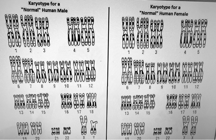 SOLVED: Karyotype for a 'Normal' Human Male Karyotype for a 'Normal' Human Female Ib D HMUAHHHAH ...
