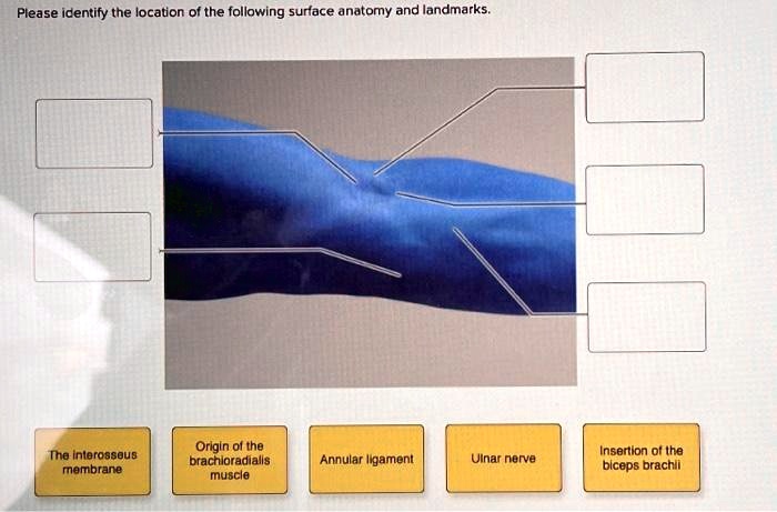 please identify the location of the following surface anatomy and ...