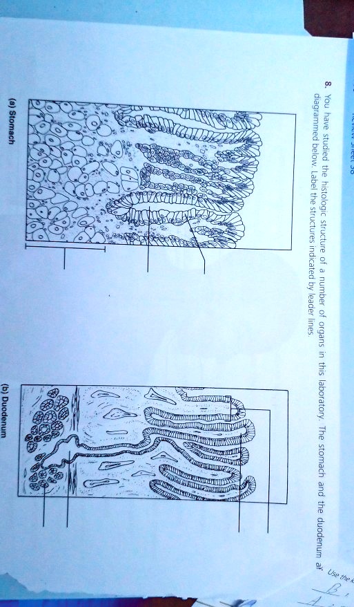 SOLVED: You have studied the histologic structure of a number of organs ...