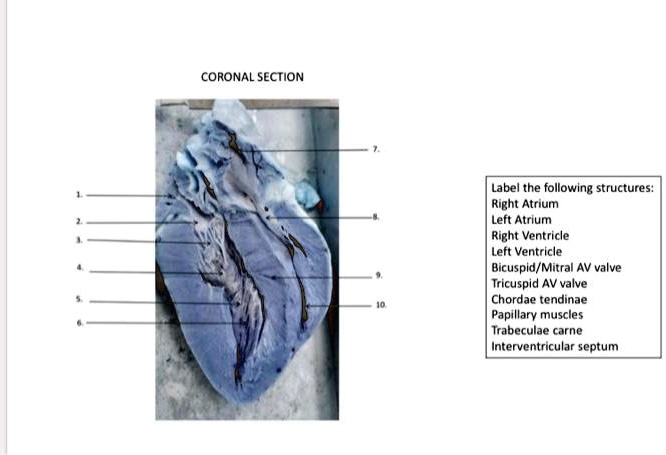 CORONAL SECTION 7. 8. 9. 10. Label the following structures: Right ...