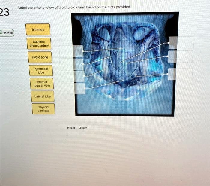 Label the anterior view of the thyroid gland based on the hints ...