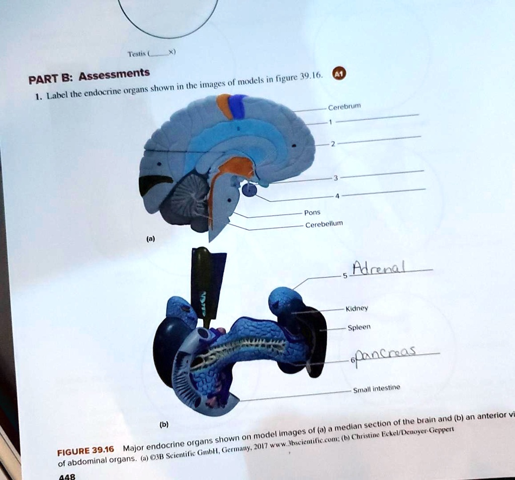 Testis(x) PART B: Assessments Label the endocrine organs shown in the ...